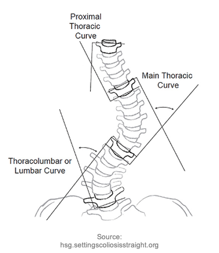 Scoliosis Tools